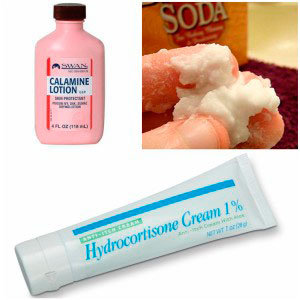 Ointment For Bed Bug Bites